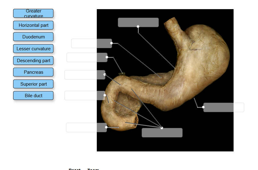 LABLE THE STOMACH AND DUODENUM USING THE HINTS | Chegg.com