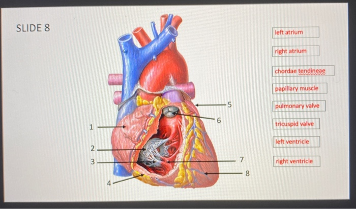 Solved SLIDE 6 left circumflex artery left marginal artery | Chegg.com