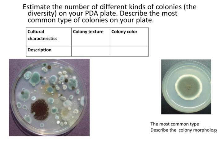 Solved Lab -9 Microbial Ubiquity Х Results: Quantitative | Chegg.com