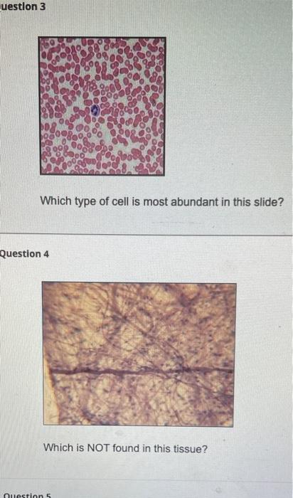 Solved Question 1 What type of tissue is seen here? Question | Chegg.com