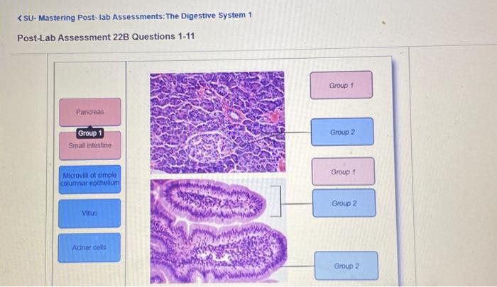 Solved Complete the labeling activity by ldentilying organs | Chegg.com