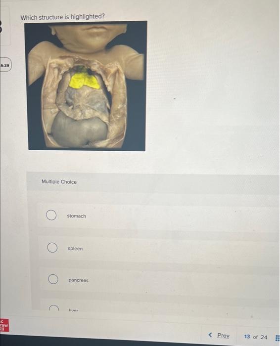 Solved Which structure is highlighted? Multiple Choice | Chegg.com