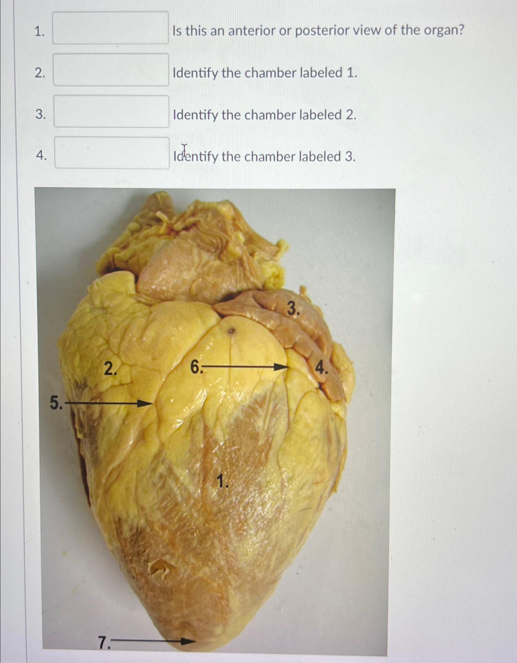 Solved Is this an anterior or posterior view of the | Chegg.com