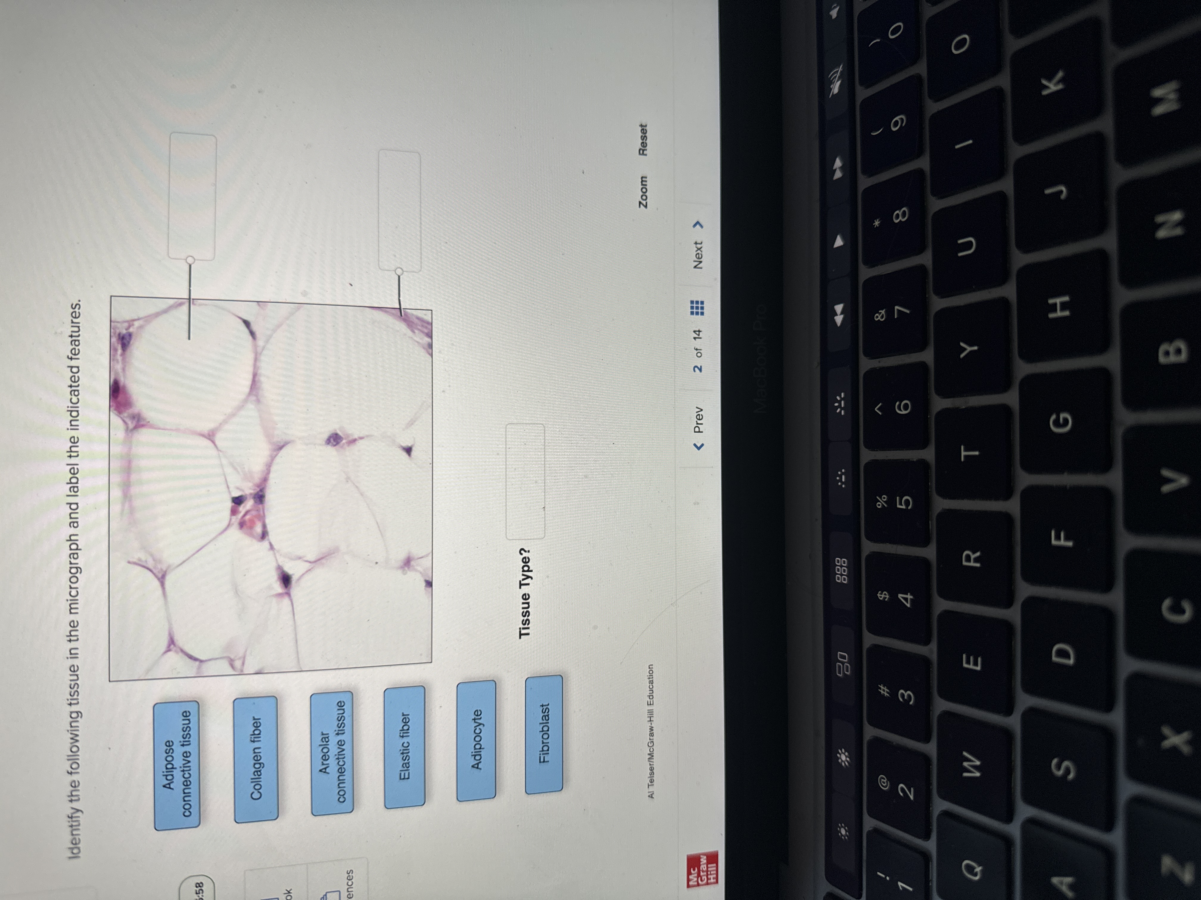 Solved Identify the following tissue in the micrograph and | Chegg.com