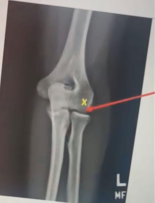 Solved What is the part of the bone indicated by the yellow | Chegg.com