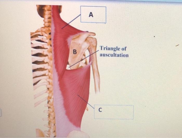 Solved A B Triangle of auscultation С medial superomedial | Chegg.com