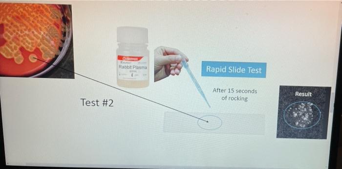 Solved Test #1 CVS Hydrogen Peroxide Rapid Slide Test SER ह | Chegg.com