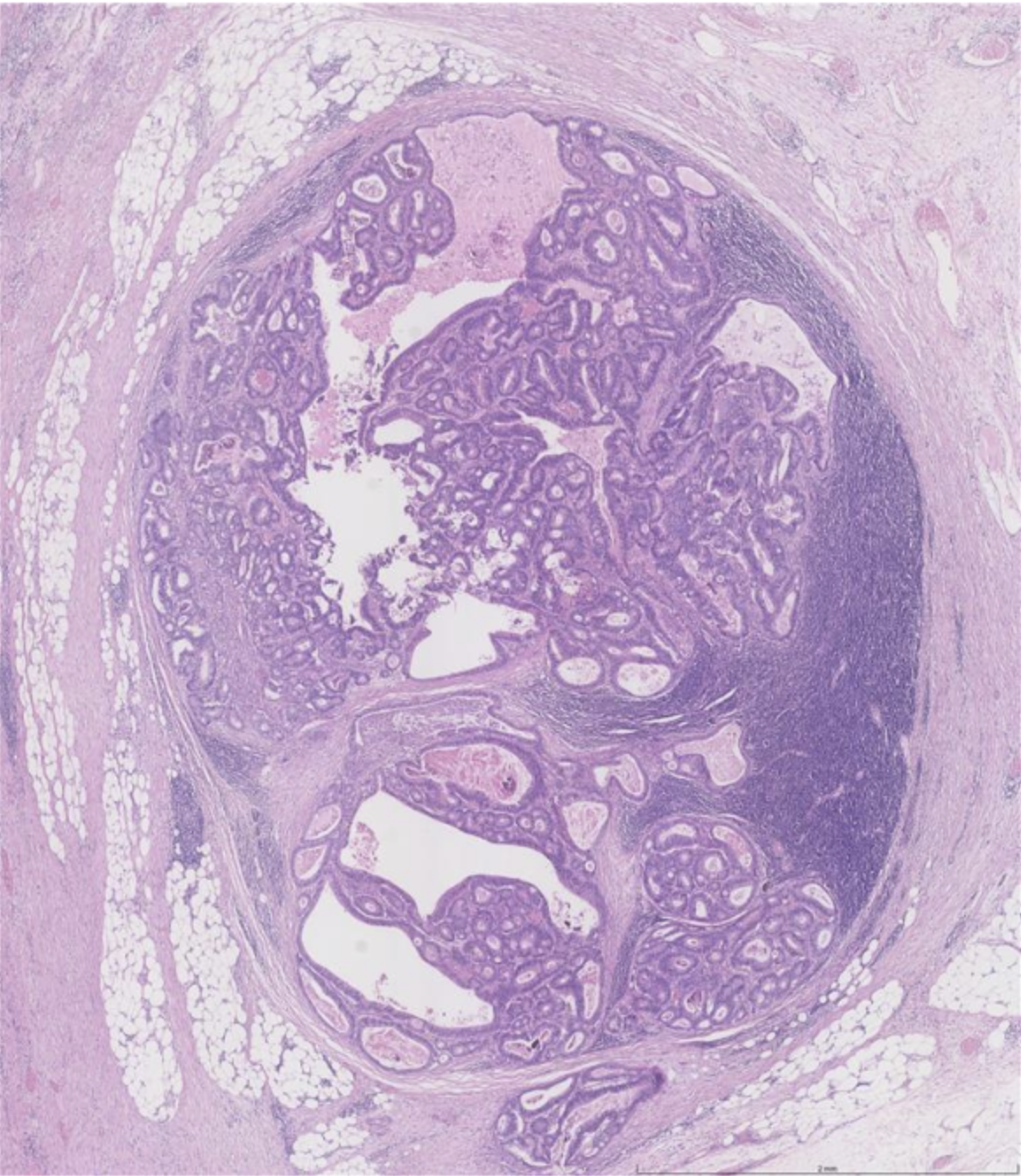 Solved The patient of this case study is a 68-year-old man | Chegg.com