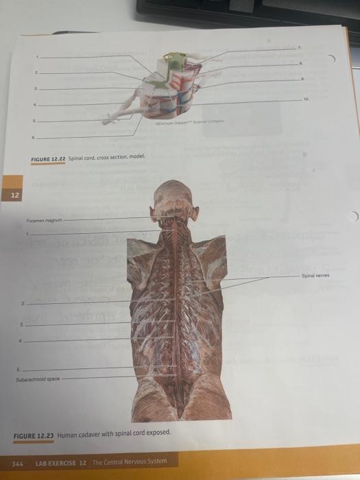 FIGURE 12.22 Spinal cord, cross section, modet. | Chegg.com