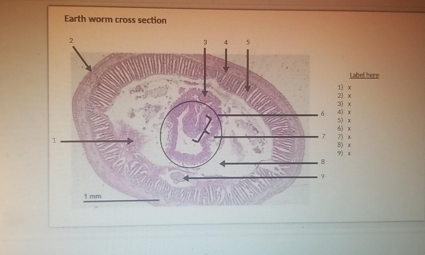 Solved Earth worm cross section 5 Label here 1) x 2) X 3) X | Chegg.com