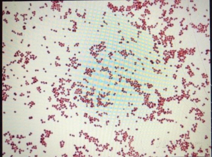Solved Unknown Bacteria1. Endospore Stain Results (positive | Chegg.com