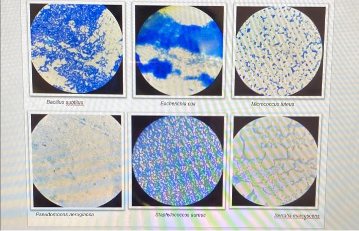 Solved Laboratory Exercise: Simple Staining Materials Heat | Chegg.com