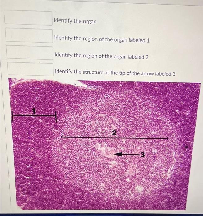 Identify the organ. Identify the region of the organ | Chegg.com Identify the organ. Identify the region of the organ | Chegg.com