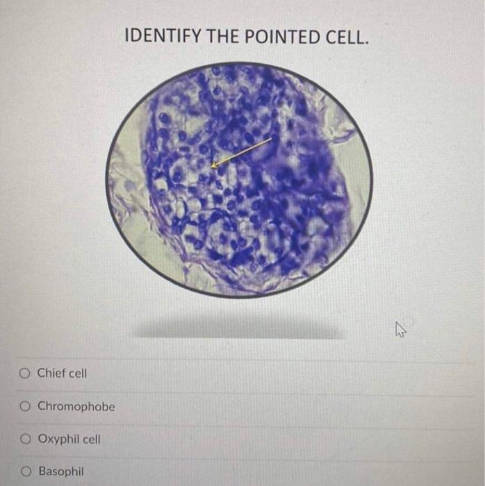 Solved IDENTIFY THE POINTED CELL. O Chief cell O Chromophobe | Chegg.com
