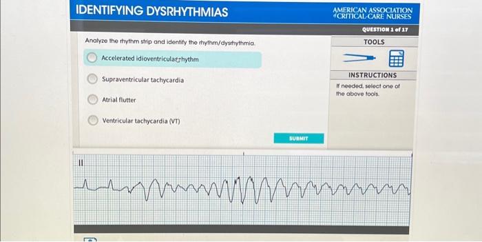 Solved IDENTIFYING DYSRHYTHMIAS II Analyze the rhythm strip | Chegg.com