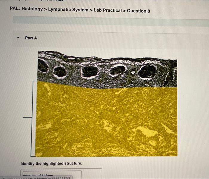 Solved PAL: Histology > Lymphatic System > Lab Practical > | Chegg.com