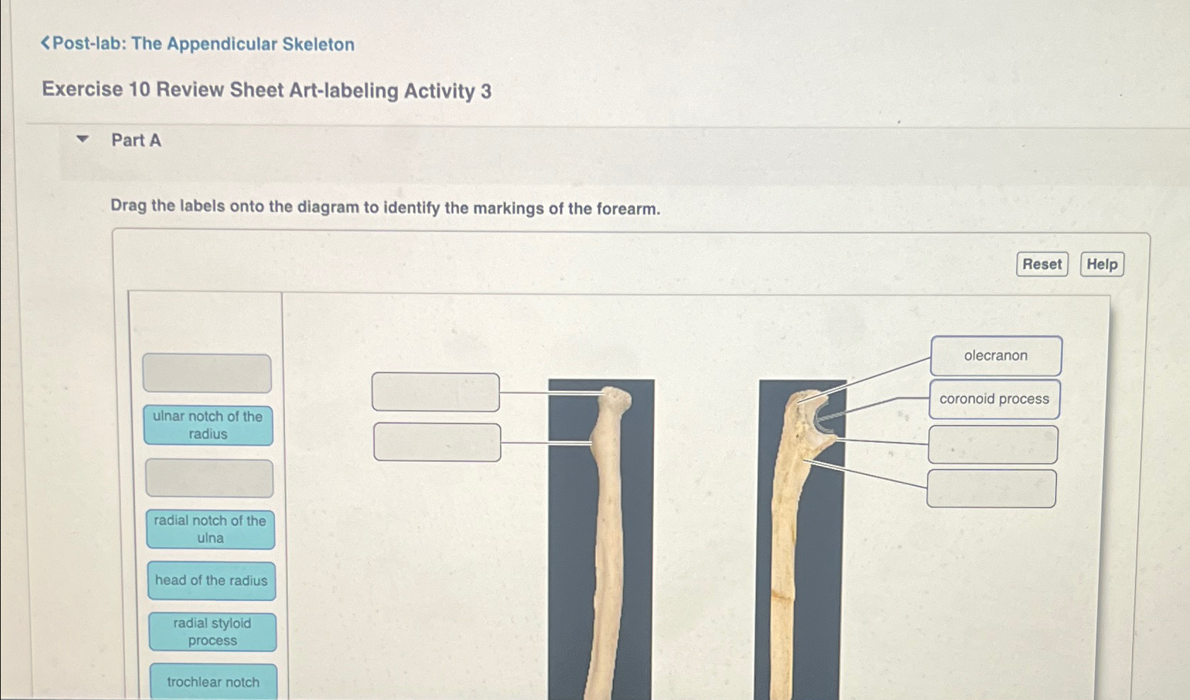 Solved Post-lab: the appendicular skeletonexercise 10 | Chegg.com