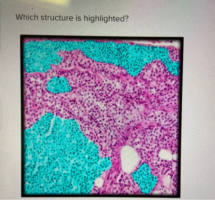 Solved Which structure is highlighted? | Chegg.com