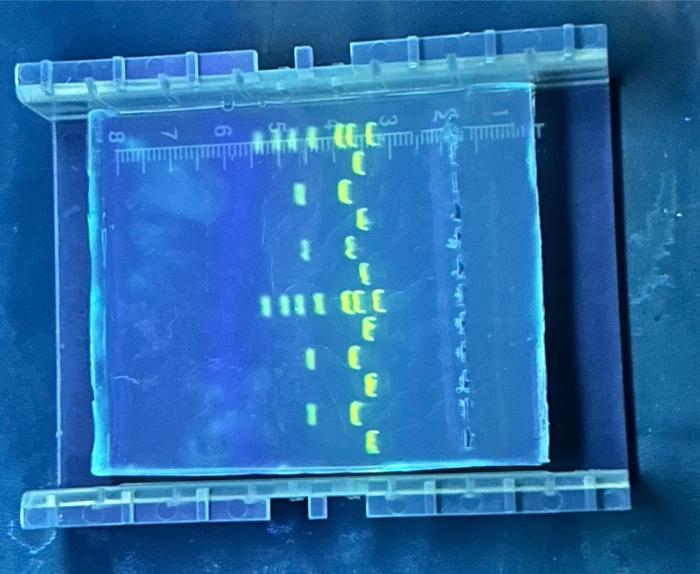 Solved Gel Electrophoresis Results The DNA ladder contains | Chegg.com