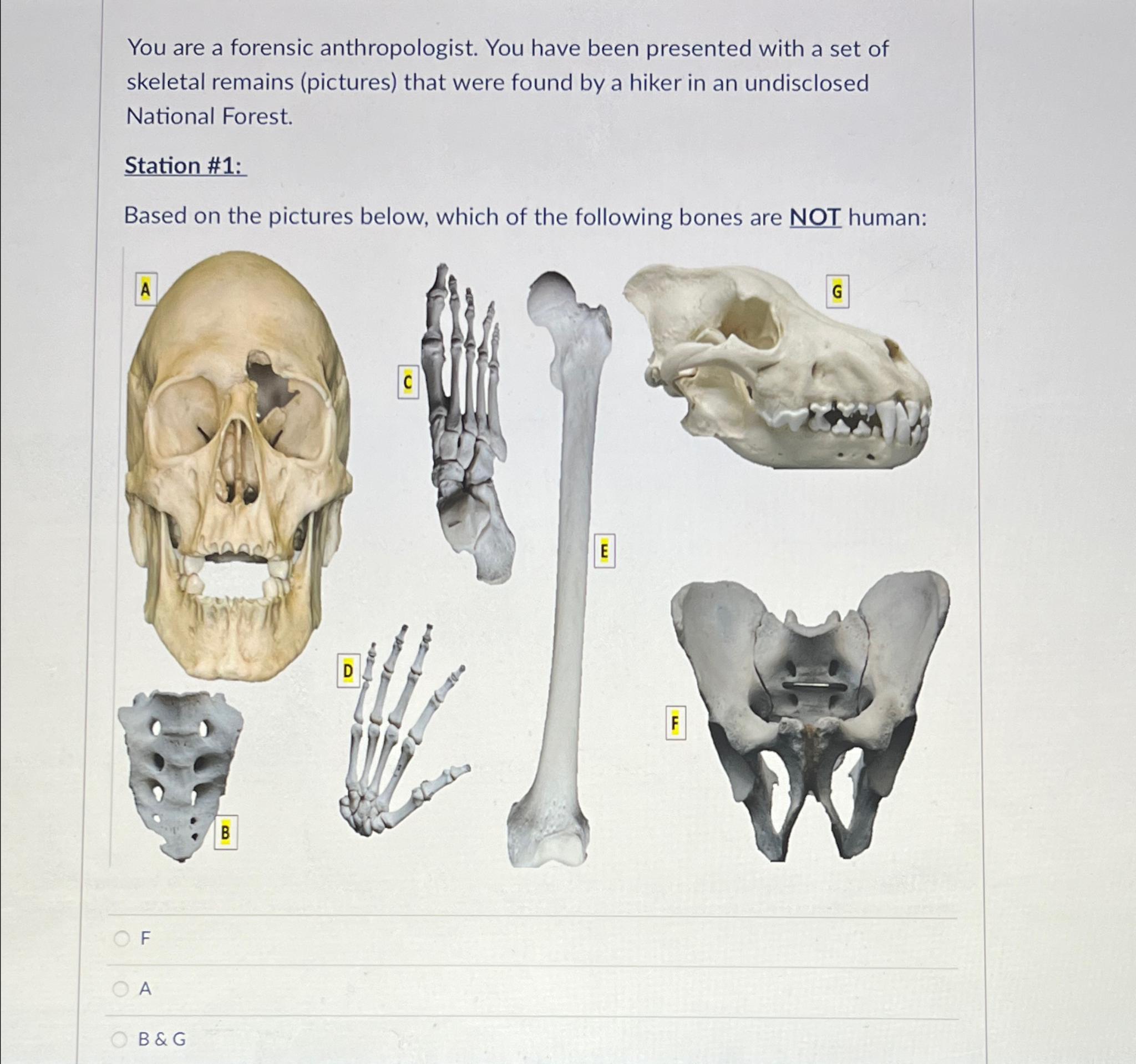 Solved You are a forensic anthropologist. You have been | Chegg.com