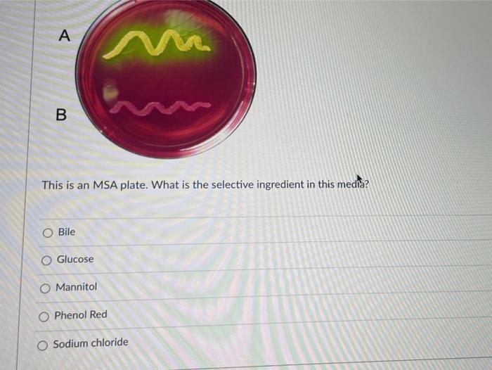 Solved A m B. This is an MSA plate. What is the selective | Chegg.com