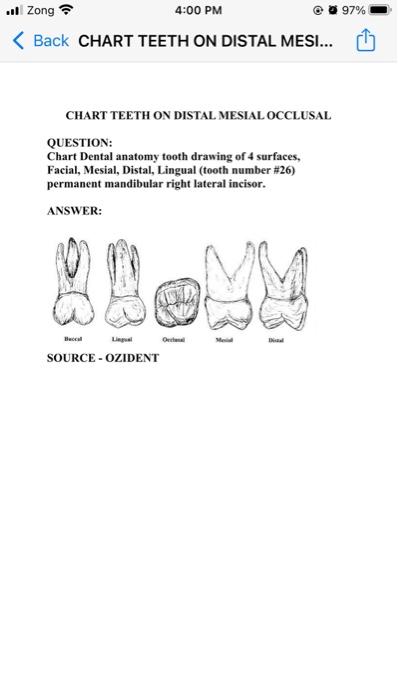 CHART TEETH ON DISTAL MESIAL OCCLUSAL QUESTION: Chart | Chegg.com