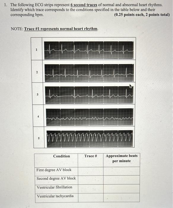 1. The following ECG strips represent 6 second traces | Chegg.com