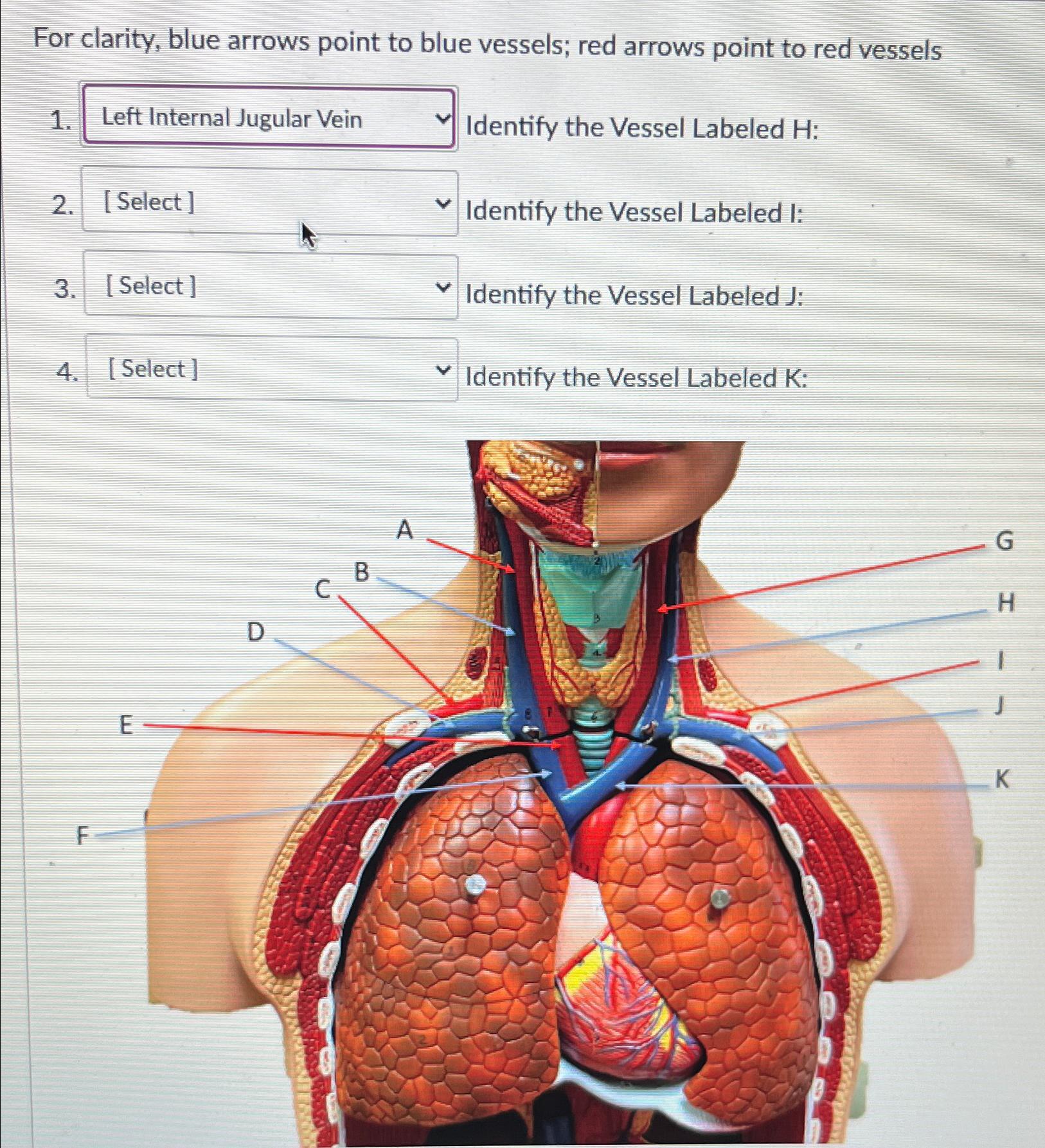 Solved For clarity, blue arrows point to blue vessels; red | Chegg.com