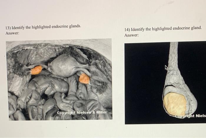 Solved 13) Identify the highlighted endocrine glands. | Chegg.com