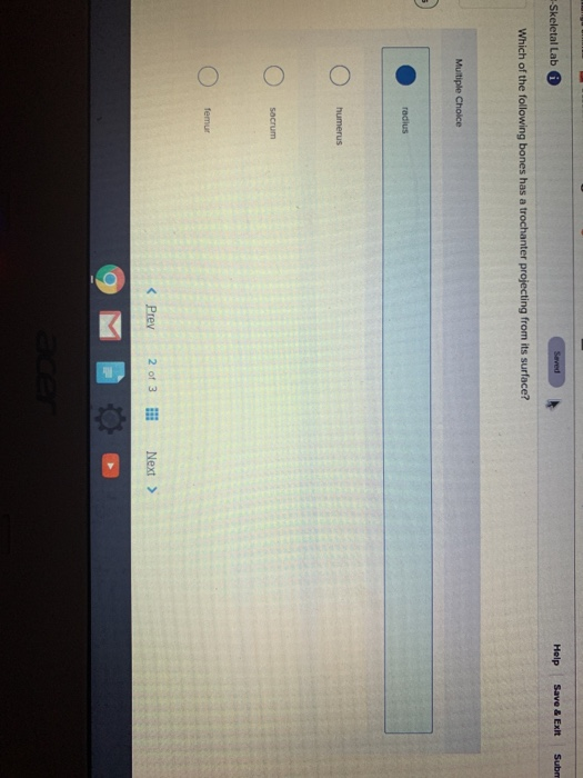 Solved Skeletal Lab Seved Help Save & Exit Subm Which of the | Chegg.com