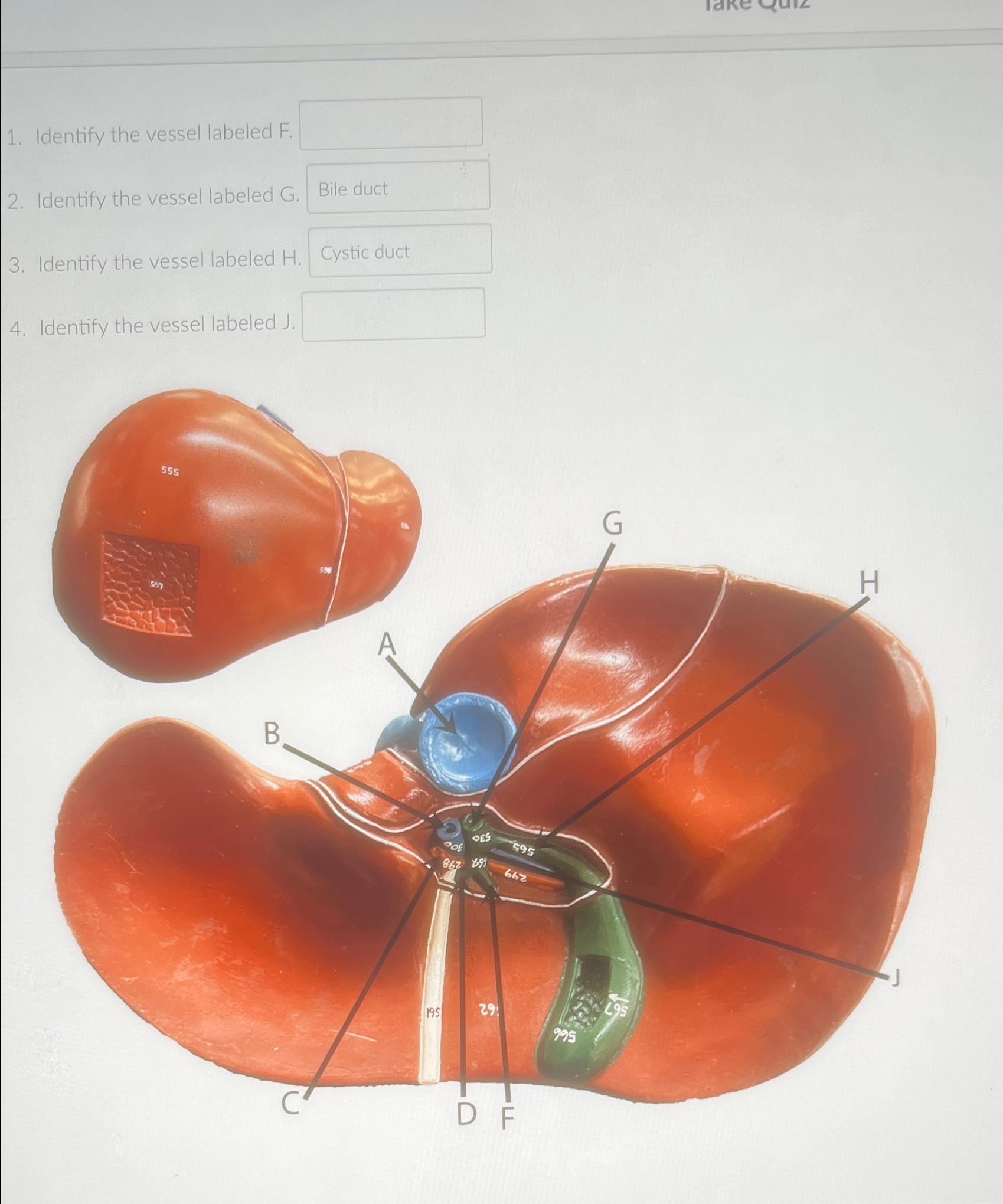 Solved Identify the vessel labeled F.Identify the vessel | Chegg.com Solved Identify the vessel labeled F.Identify the vessel | Chegg.com