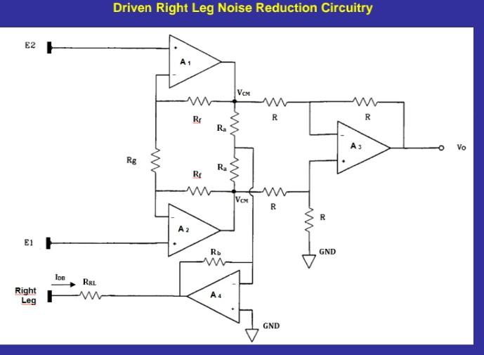 Solved Driven Right Leg Noise Reduction Circuitry | Chegg.com