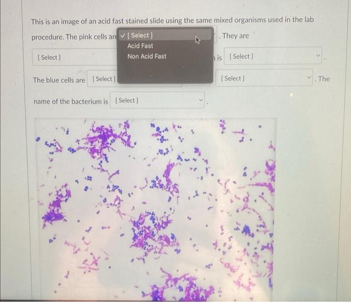 Solved This is an image of an acid fast stained slide using | Chegg.com