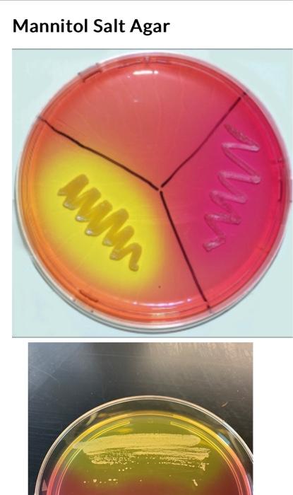 EXERCISE 14: BLOOD AGAR PLATE(BAP) Complete the table | Chegg.com