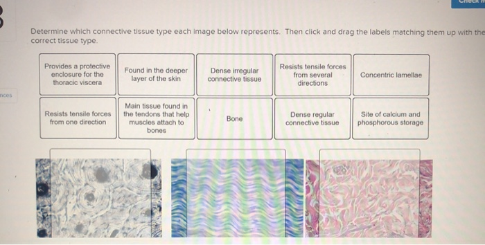 Solved Determine which connective tissue type each image | Chegg.com
