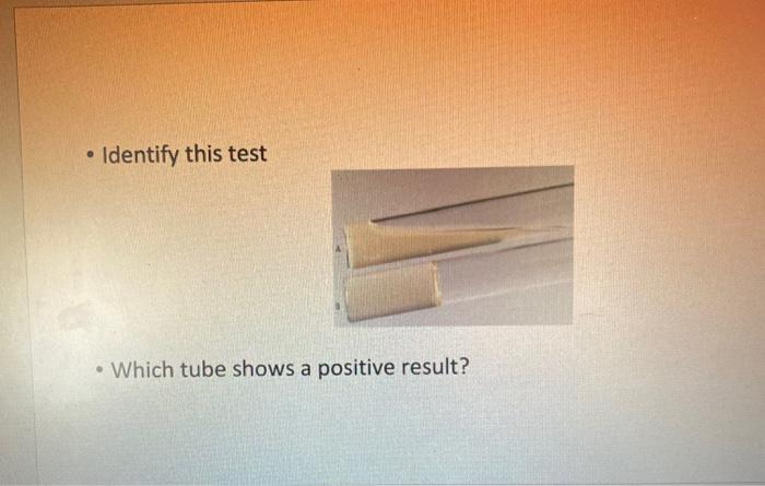 Solved Identify this test. Which tube shows a positive | Chegg.com