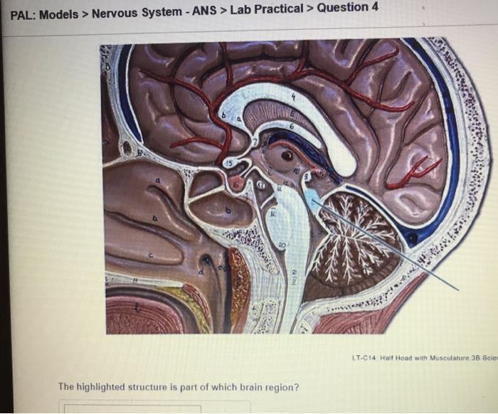 Solved PAL: Models > Nervous System - ANS > Lab Practical > | Chegg.com