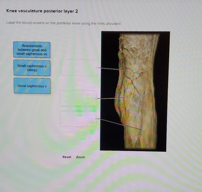 Solved Knee vasculature posterior layer 2 Label the blood | Chegg.com