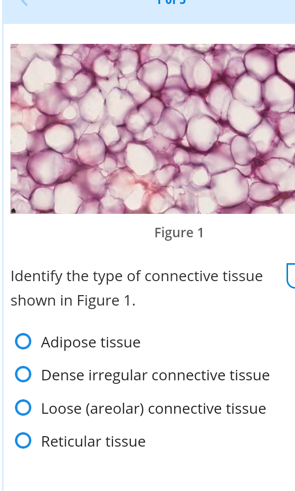 Solved Figure 1 Identify the type of connective tissue shown | Chegg.com