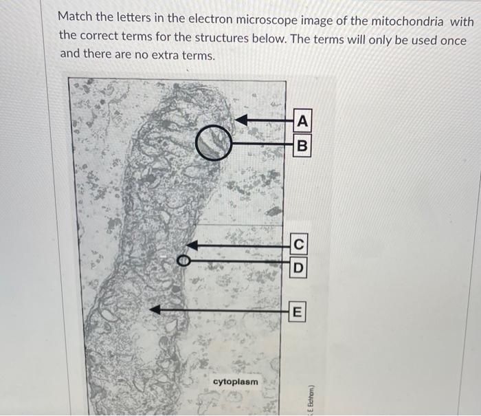 Solved Match the letters in the electron microscope image of | Chegg.com