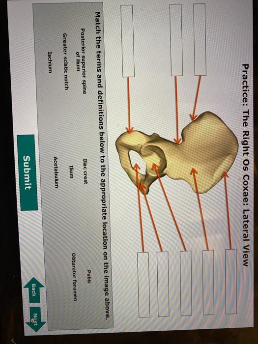 Solved Practice: The Right Os Coxae: Lateral View Match the | Chegg.com