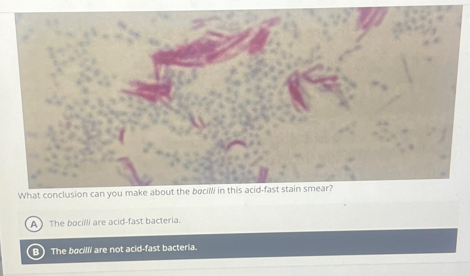 Solved What conclusion can you make about the bacilli in | Chegg.com