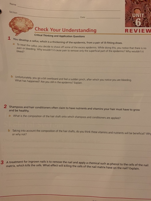 Solved Name Section UNIT Date 1 You develop ac Check Your | Chegg.com