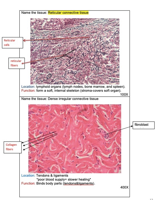 Solved + Name the tissue: simple columnar epithelium nuclei | Chegg.com