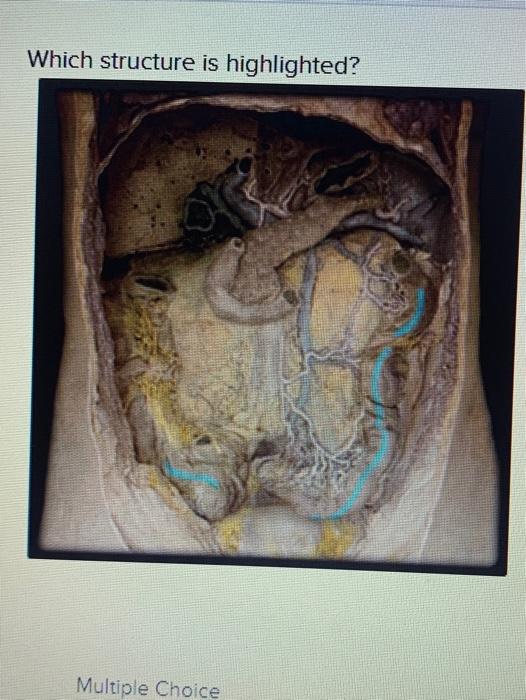 Solved Which structure is highlighted? Multiple Choice О O | Chegg.com