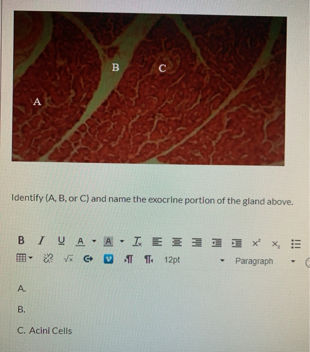 Solved Identify (A, B, or C) and name the exocrine portion | Chegg.com