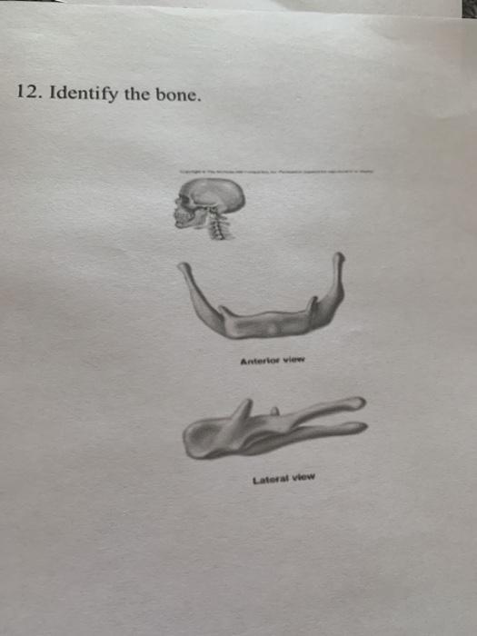 Solved 12. Identify the bone. Anterior view Lateral view | Chegg.com