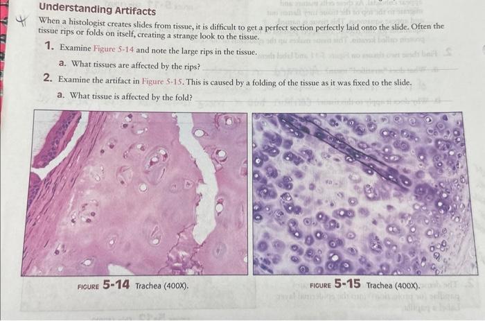 Solved Understanding Artifacts When a histologist creates | Chegg.com