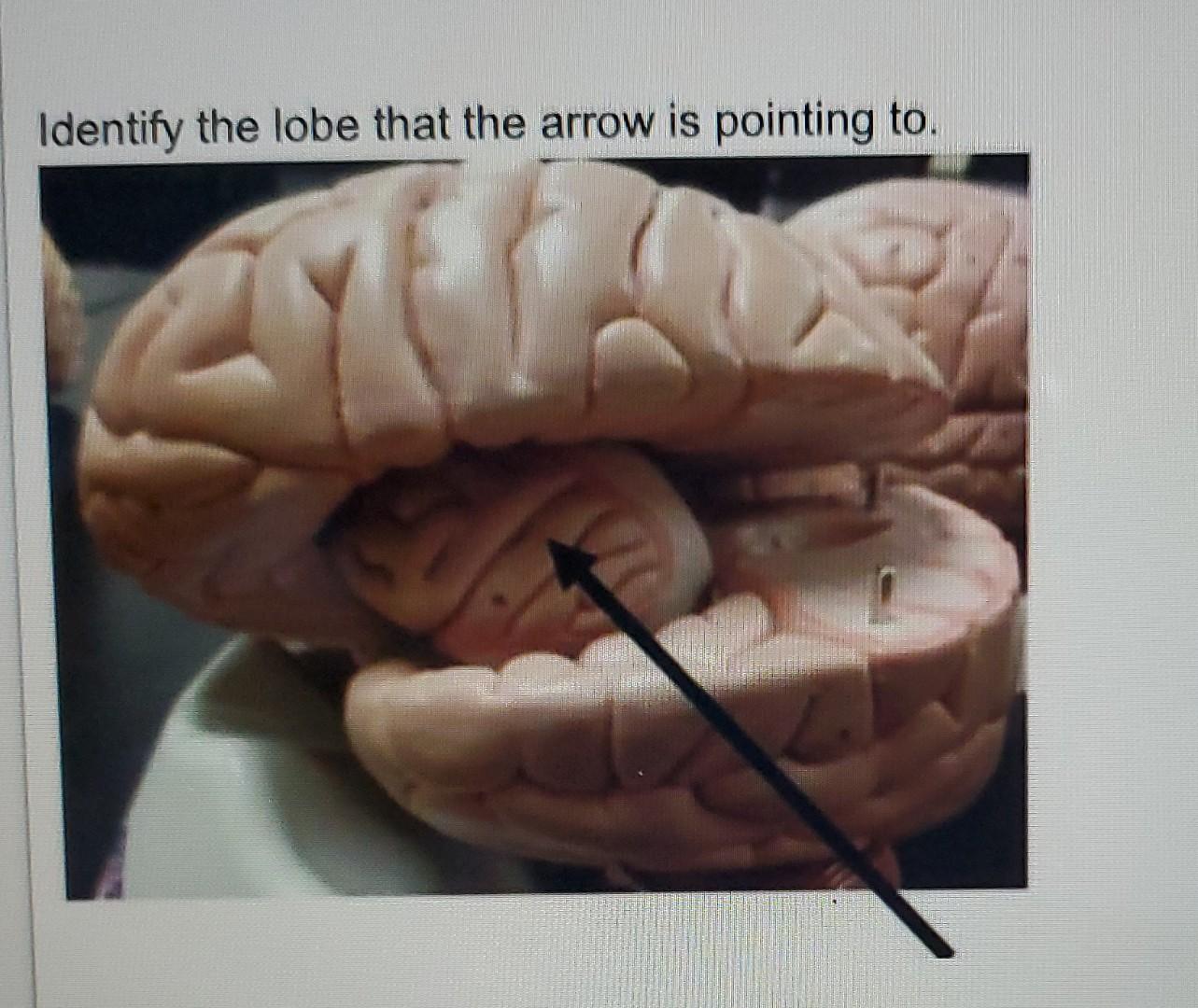 Solved Identify the lobe that the arrow is pointing to. | Chegg.com