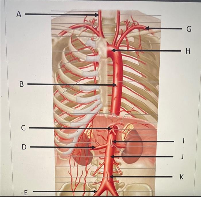 Solved uiz Instructions Question 1 2 pts v [Choose] Artery | Chegg.com